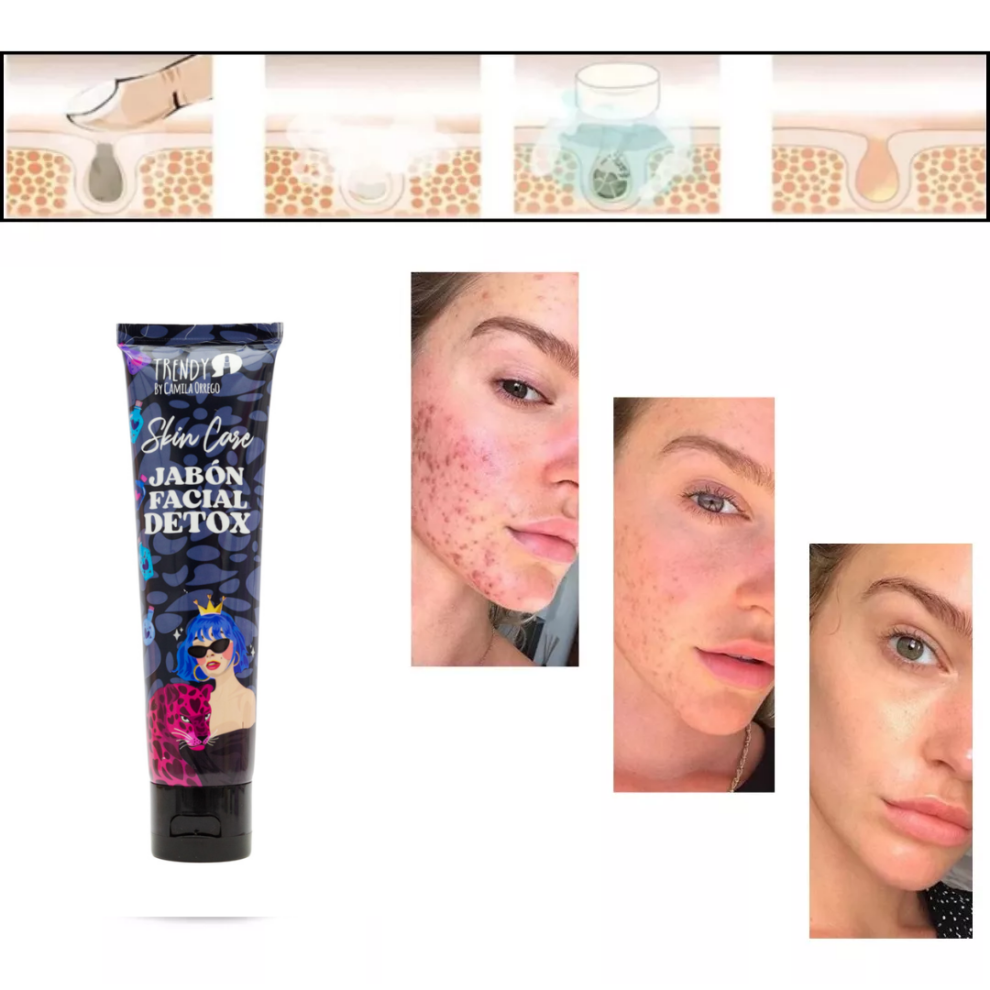 Colapsible Jabón Antiacné Trendy Detox 110 Gr - Kroma Space